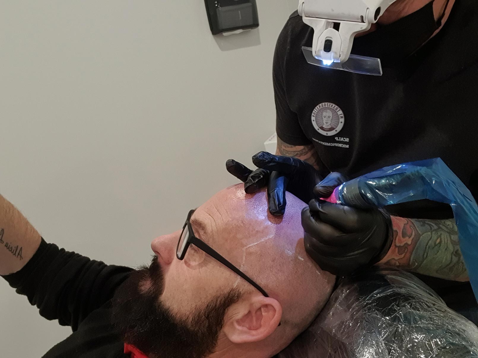 Scalp Micropigmentation Perth (SMP), Hair Tattoo Perth, Beard Tattoo ...